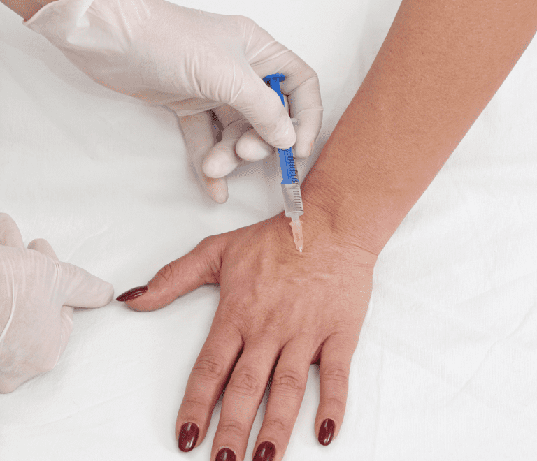 How Hand Fillers Works And Their Benefits | Saint Aesthetix